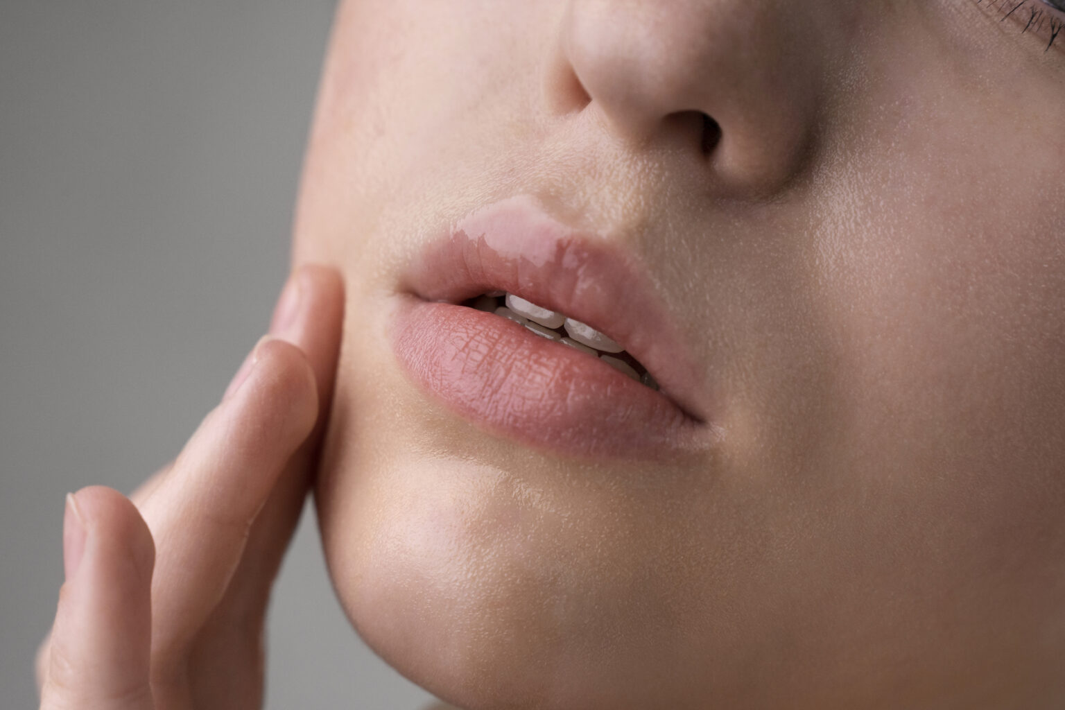 Opryszczka na ustach: Przyczyny, objawy i skuteczne sposoby leczenia krostek i pęcherzyków ...