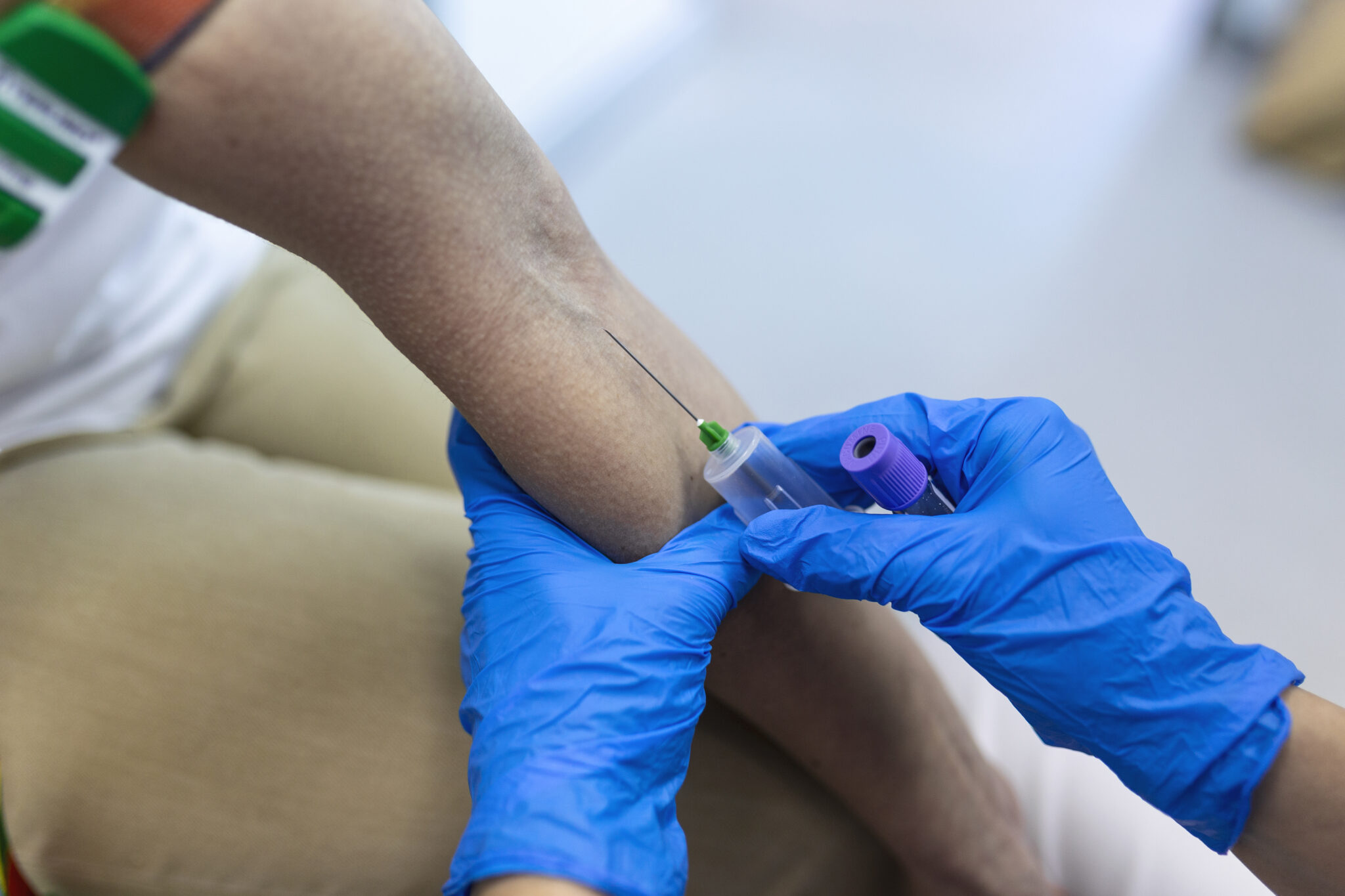 O czym świadczy obniżony poziom bazofili? Analiza morfologii krwi ...